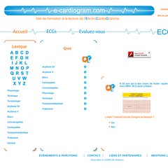 www.E-cardiogram.com - Formation à « l’ECG